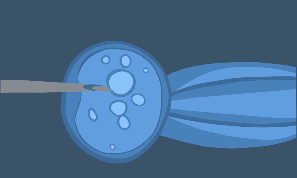 Zygote Intrafallopian Transfer Zift Diccionario De Internet 0633
